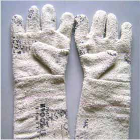 Laboratory Analysis: A Look at Asbestos Exposure in a Clinical Environment